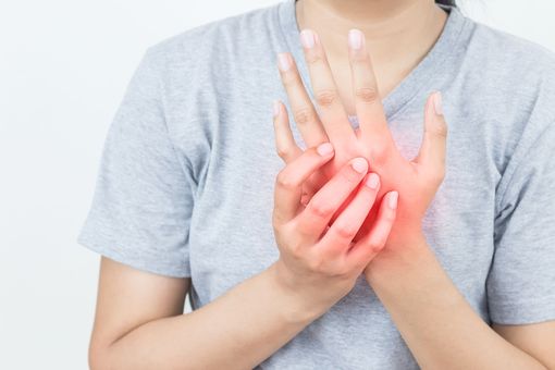 Turvonneet sormet: 10 selitystä vaivalle