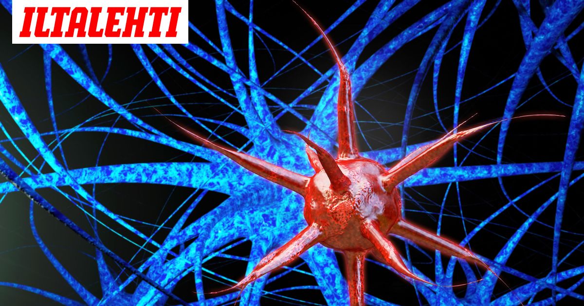 Tällainen on ALS-tauti