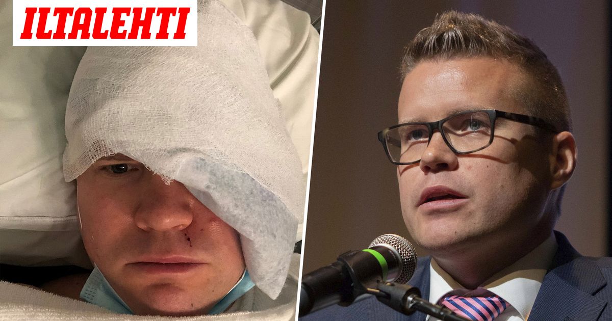 Asmo Maanselkä putosi pöntöltä, taju meni