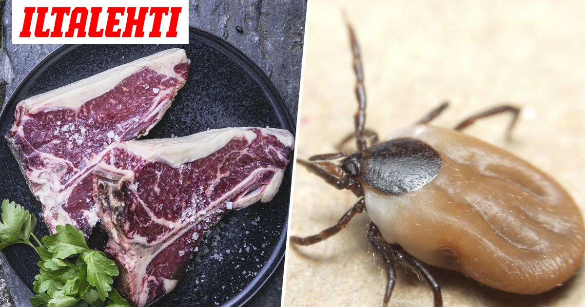 Punkkien aiheuttama liha-allergia yleistyy – Tällainen on tilanne Suomessa