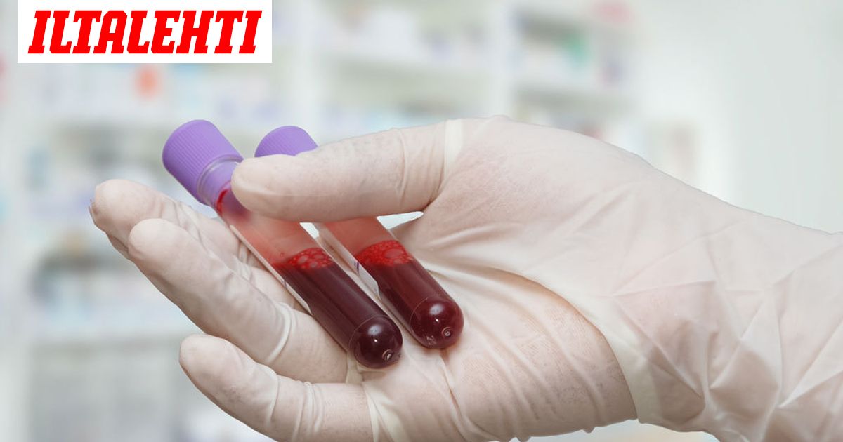 Verikoe kertoo muistisairausriskistä entistä tarkemmin - ennaltaehkäisy ...