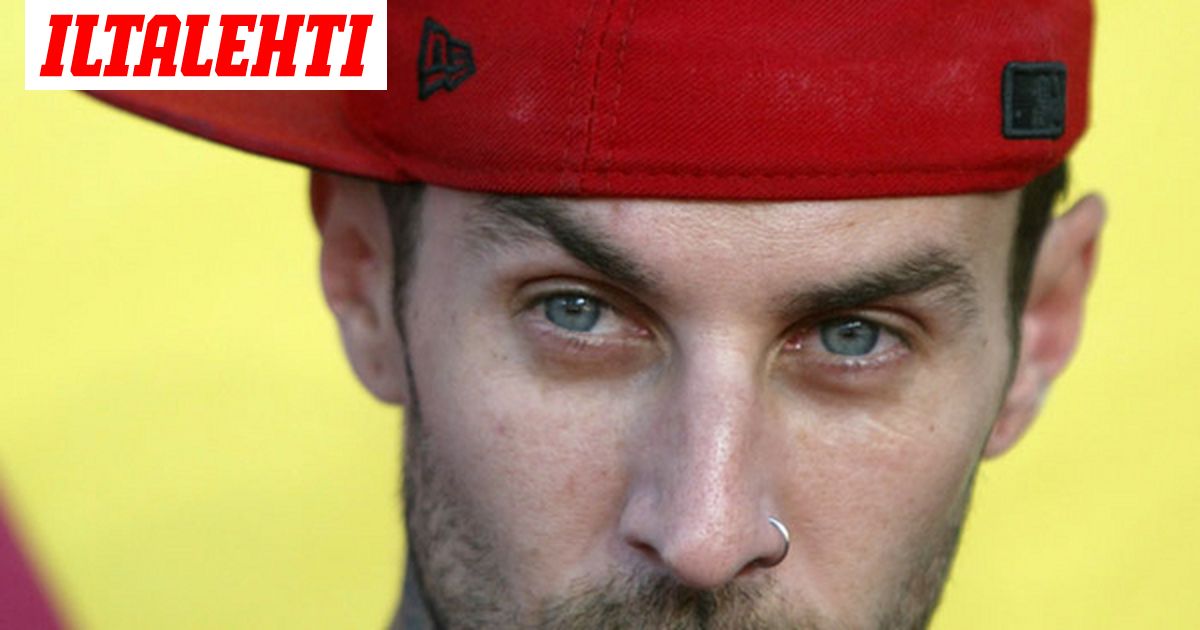 Lentoturmasta toipuva Travis Barker: Saan olla kiitollinen, että olen ...