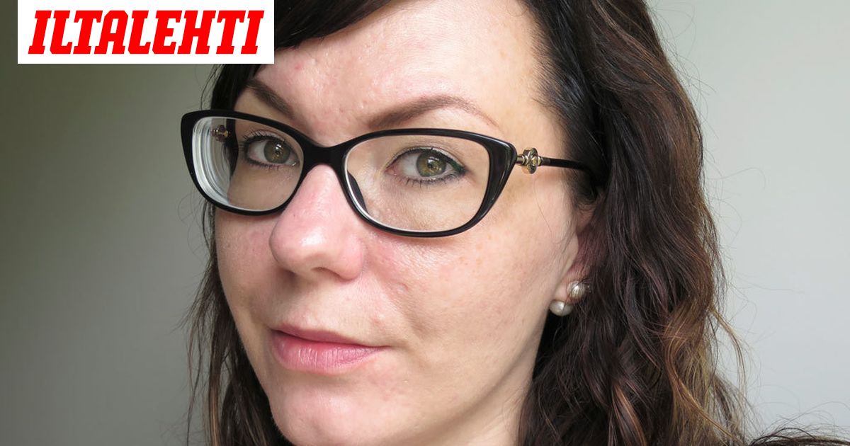 Ruusufinni on kiusallinen vaiva: "Ihoani arvosteltiin jopa ...