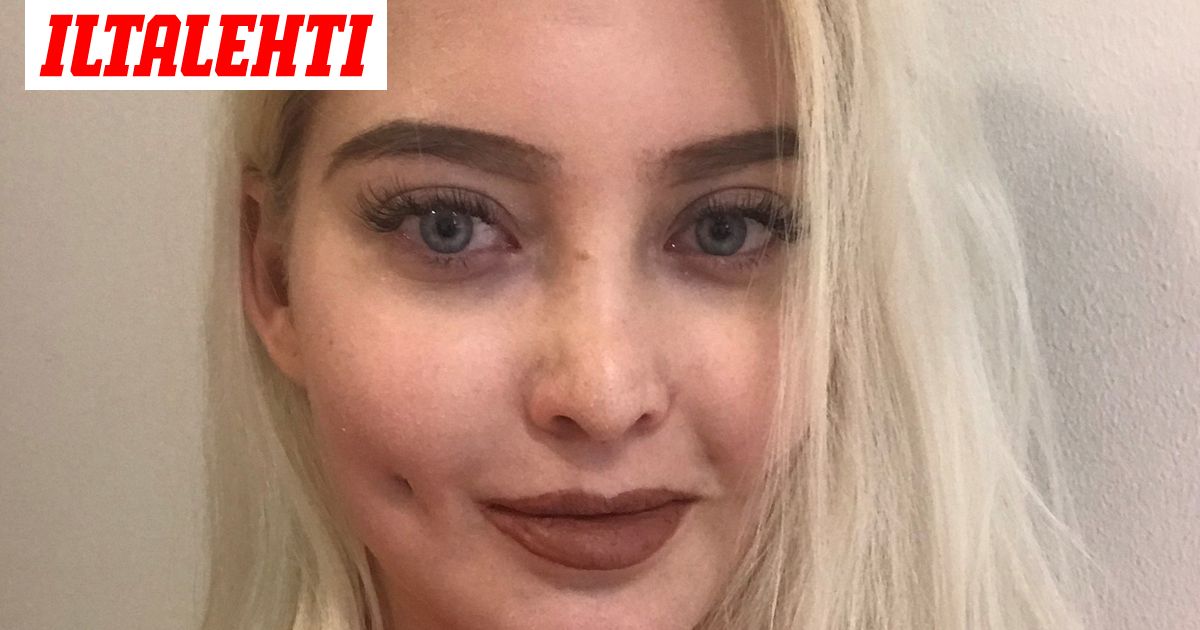 Hymykuopat kauneusleikkauksella? Janni hankki hymykuopat ...