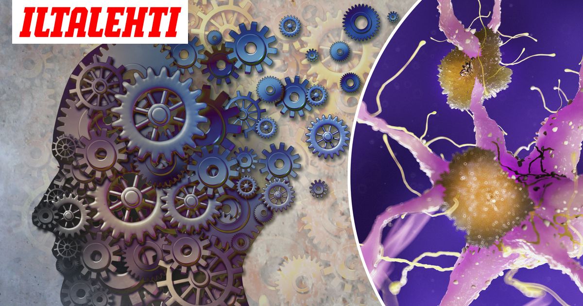Tällainen on Alzheimerin tauti: ensimmäisen oireet