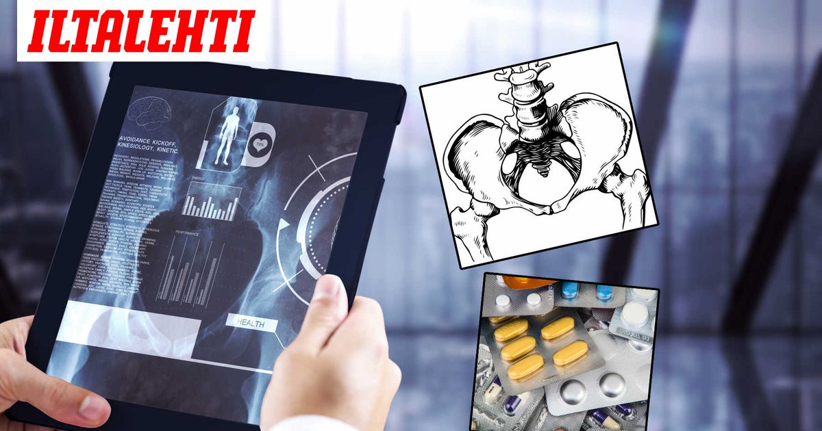 Difallia: erittäin harvinainen kahden peniksen tila aiheuttaa monia ...