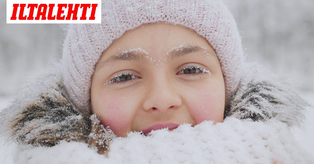 Älä hoida paleltumaa niin kuin ensin mieleen tulisi!