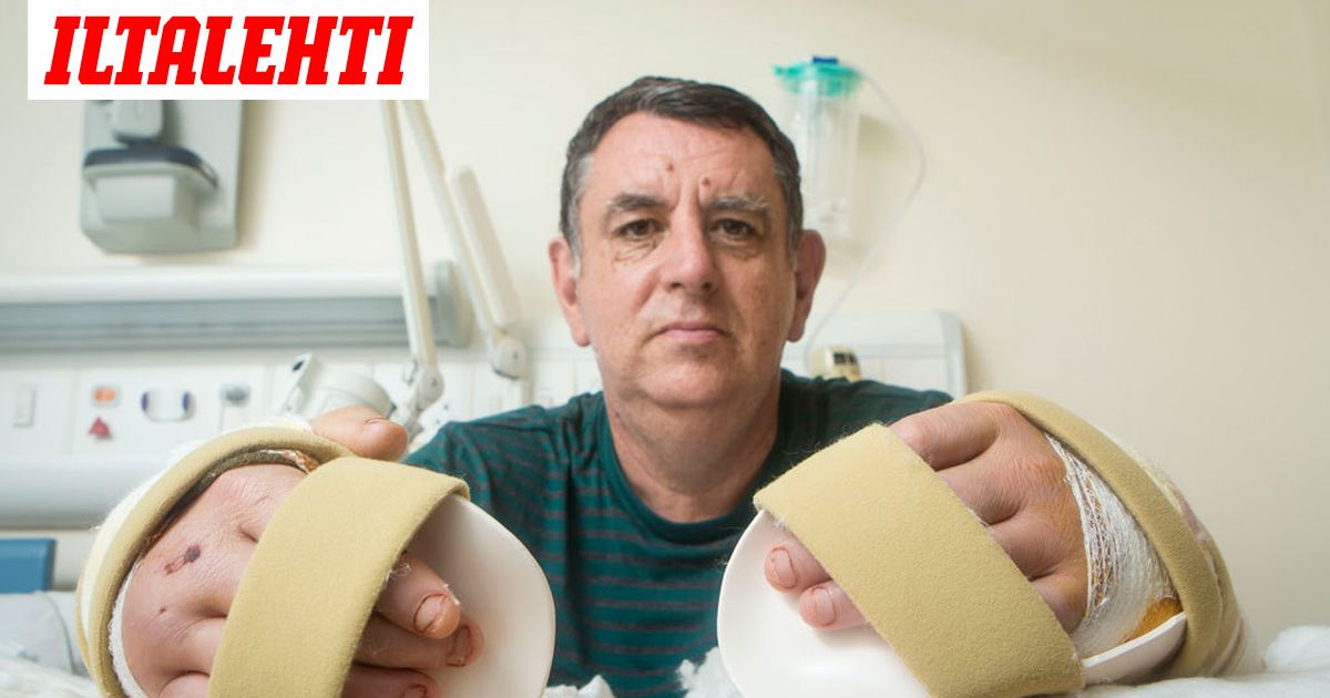 "Parempaa kuin lottovoitto" - kätensä menettänyt Chris sai ...