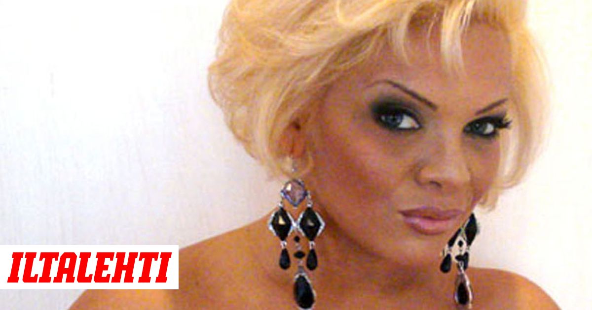 Hätäleikkaus: Maailman suurimmat rinnat muuttuivat hengenvaarallisiksi