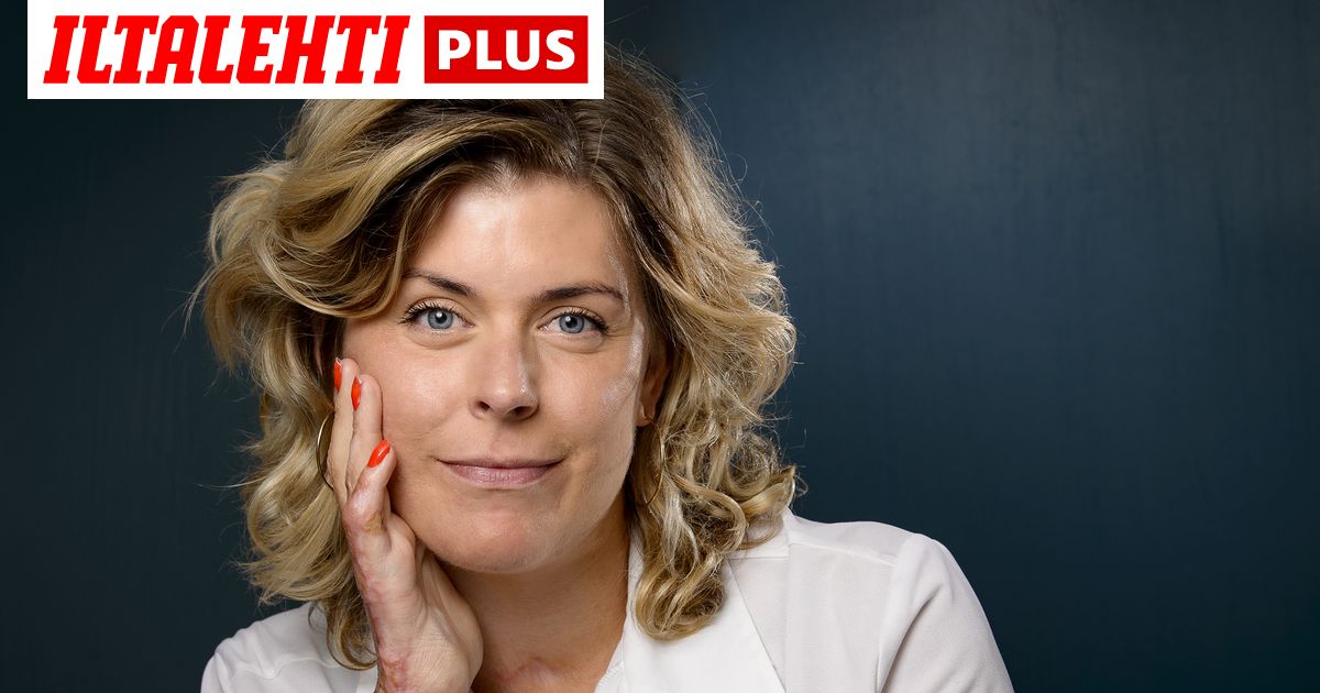 Emma pelasti lapsensa tulipalosta – sai itse vaikeat palovammat