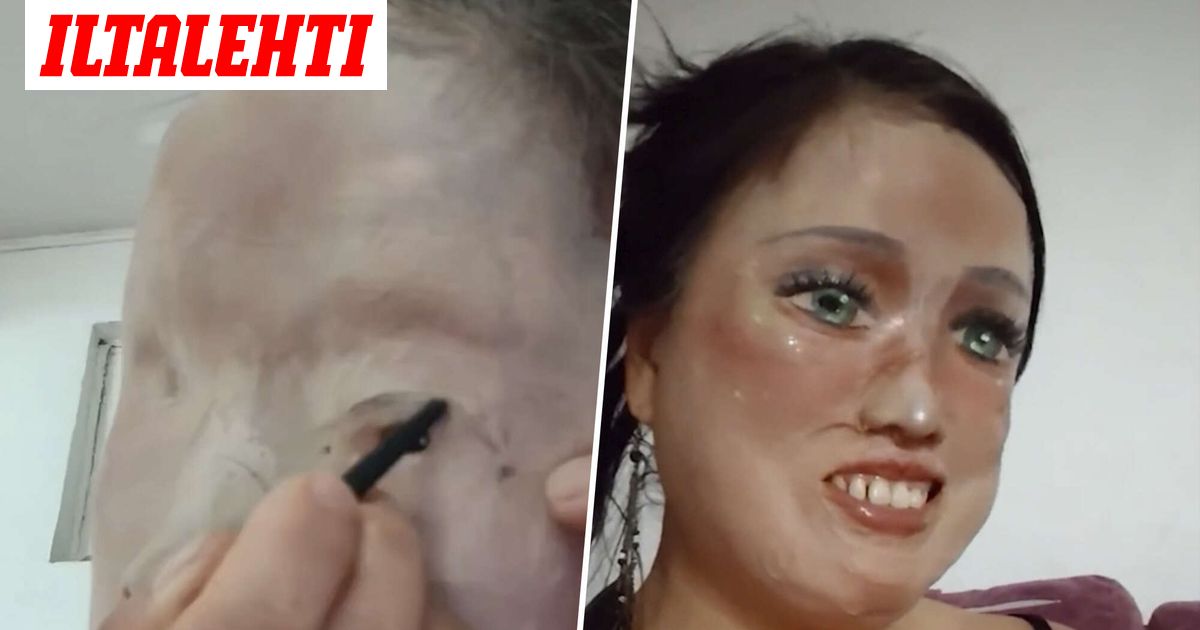 Julman happoiskun kohteeksi joutunut nainen näyttää, miten hän meikkaa ...