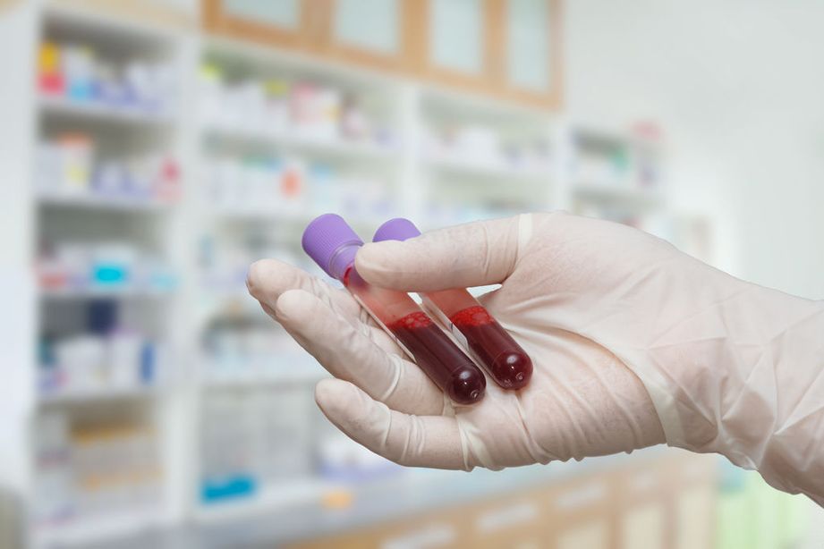 Verikoe kertoo muistisairausriskistä entistä tarkemmin - ennaltaehkäisy ...