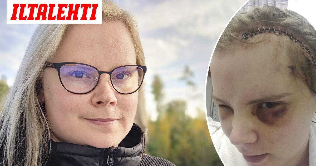 Kun kohtaus iski, Iida itki, tärisi ja oksensi vessassa – Nyt hän on ...