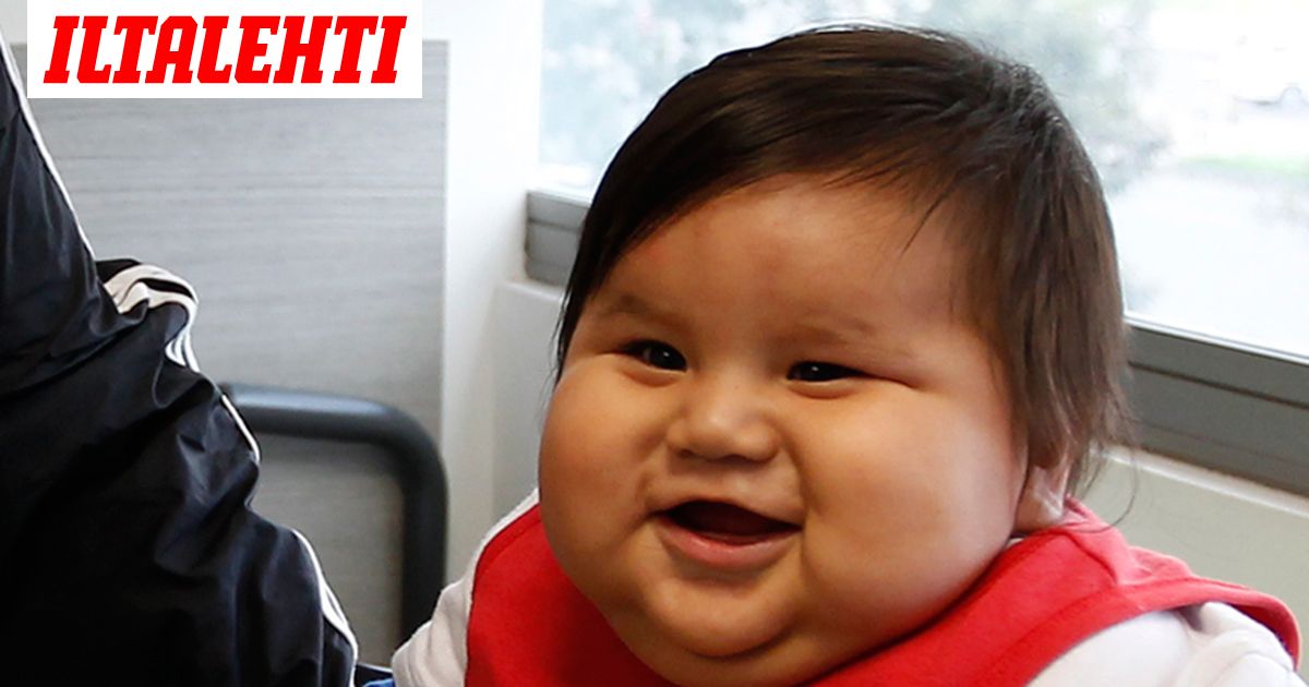 Ylipainoisen vauvan tapaus järkyttää: Painaa yhtä paljon kuin 6-vuotias