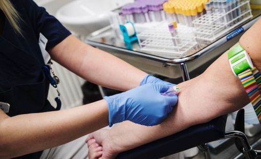 Mullistava verikoe kehitteillä: Havaitsee syöpäsolut - ja mihin elimeen ...