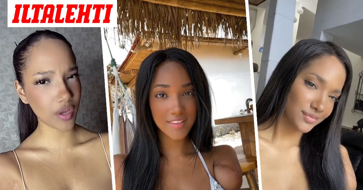 Victoria menetti 6-vuotiaana kätensä ja toisen jalkansa – nykyään hän ...