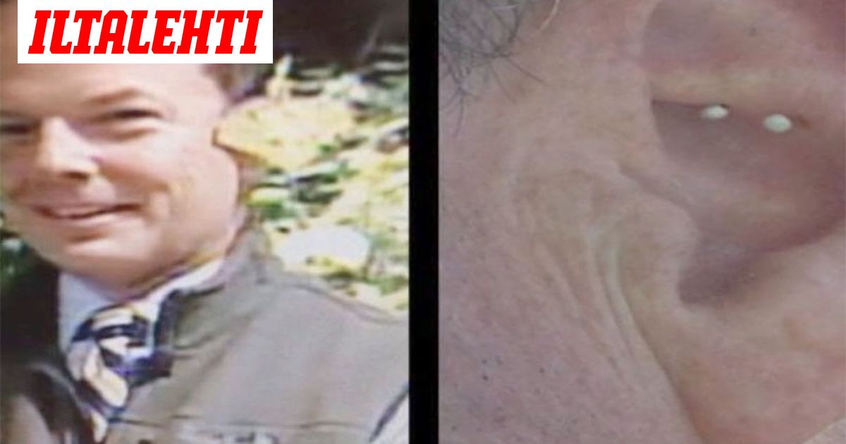 Koiperhonen muni uutisreportterin korvaan suorassa lähetyksessä