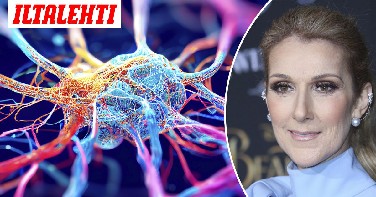 Celine Dion ja sairaus: jäykkyysoireyhtymä eli stiff person -syndrooma