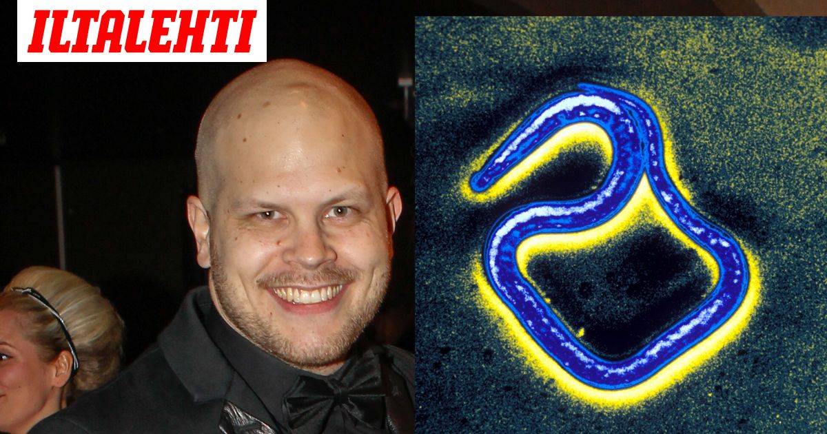 Radiojuontaja Anssi Honkanen kärsi kiusallisesta vaivasta - kutiavasta ...