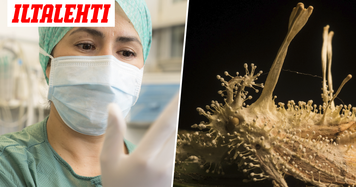 Sieni-infektiot ovat yleistyneet 15 vuoden aikana – millaisia ne ovat?