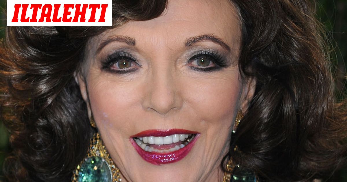 Joan Collins myöntää: Olen käyttänyt Botoxia