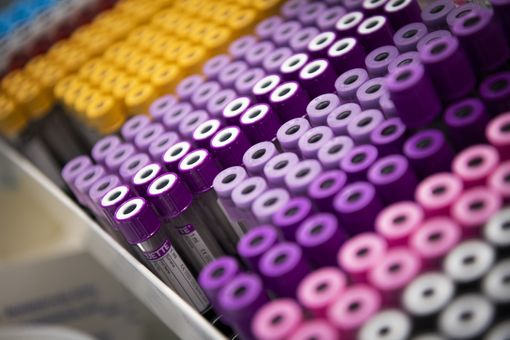 Verikoe ja perusverenkuva: neulapelko voidaan voittaa