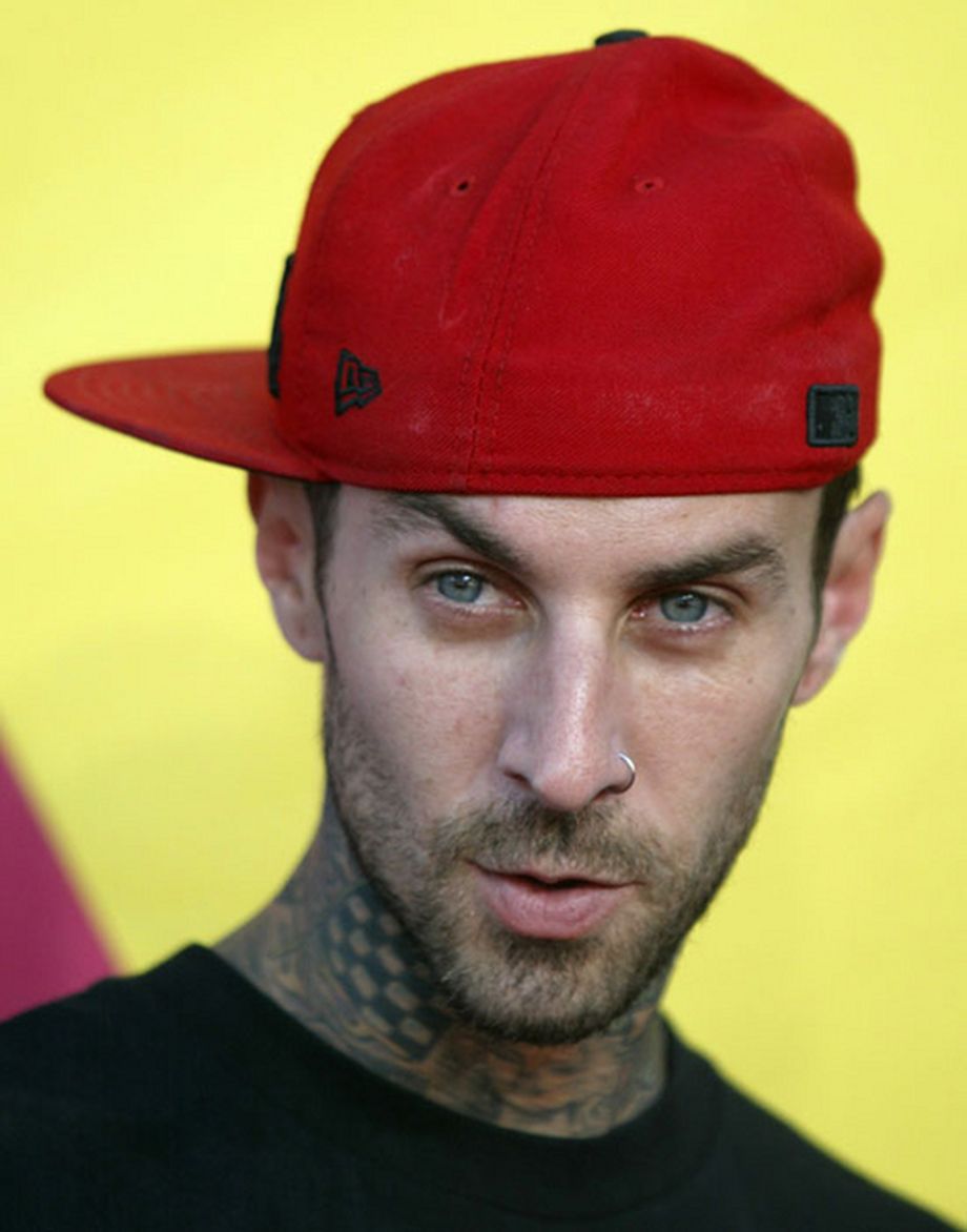 Lentoturmasta toipuva Travis Barker: Saan olla kiitollinen, että olen ...