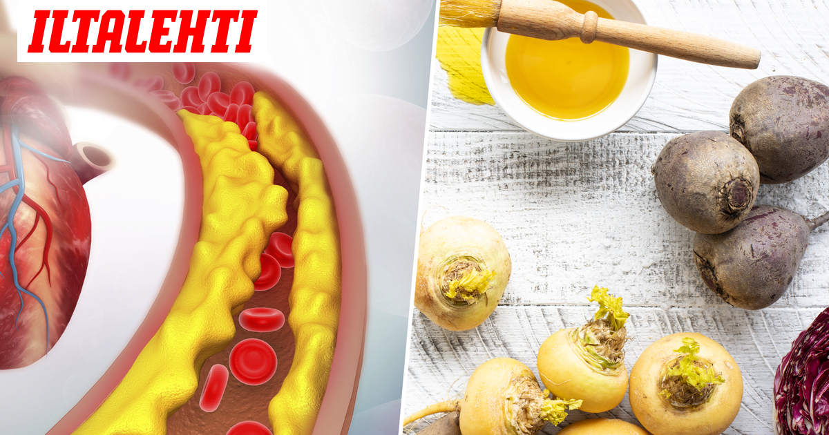 Näin usein kolesteroli pitäisi mittauttaa
