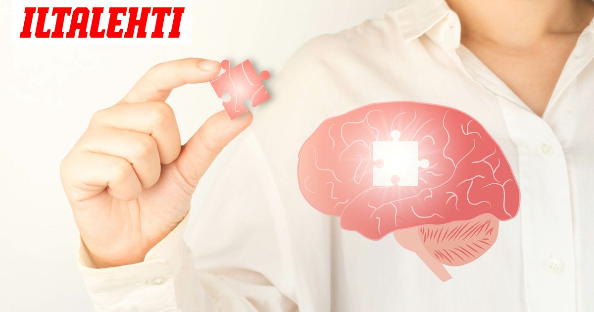 Näin Alzheimerin tauti syö aivot: kuva näyttää