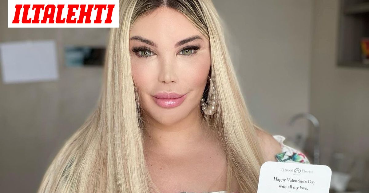 Jessica Alves kävi sukupuolenkorjausleikkauksessa