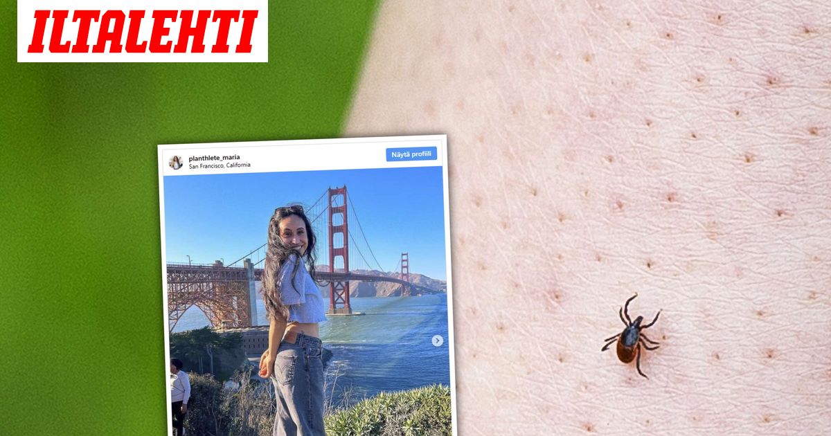 Punkin puremalla karmea seuraus – Maria Palen halvaantui