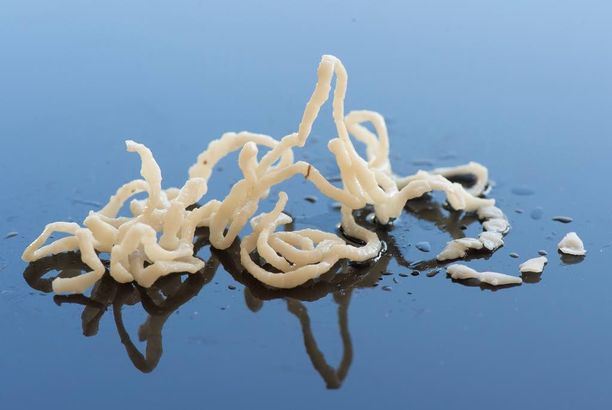 Tutkijat ällistyivät: Loismadon syöpä tarttui ja tappoi ihmisen